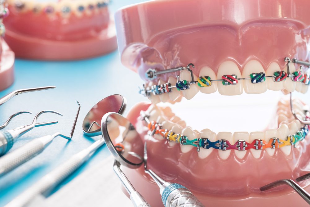 ΟΡΘΟΔΟΝΤΙΚΕΣ ΥΠΗΡΕΣΙΕΣ - SkyDental